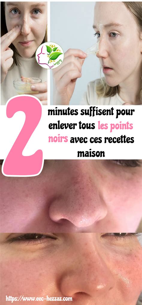 2 Minutes Suffisent Pour Enlever Tous Les Points Noirs Avec Ces