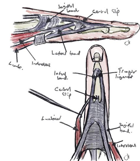 Extensor Tendon Anatomy James Henderson Specialist Plastic Hand