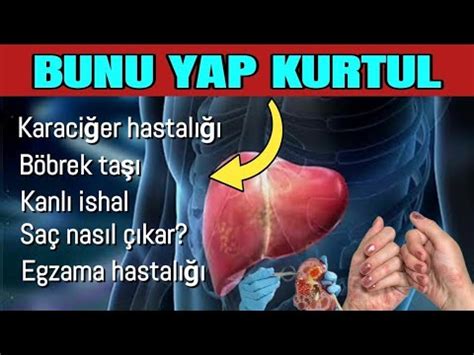 Hastalara S Per Z M Bunu Yap Kurtul Karaci Er Hastal Egzama Youtube