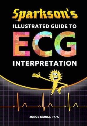 Illustrated Guide To Ecg Interpretation Litfl Book Review