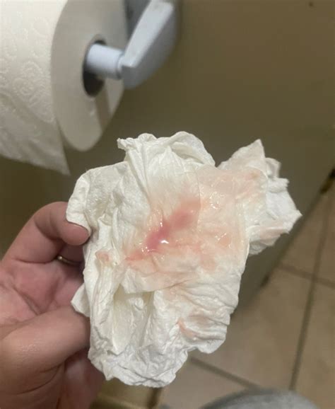 Implantation Bleeding Tmi Photo Glow Community
