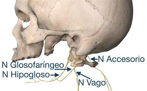 Disfunci N Del Nervio Hipogloso
