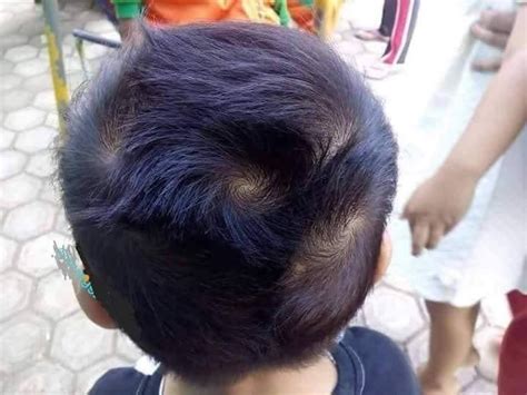 En El Nombre Competencia Pedir Disculpas Remolinos En El Cabello
