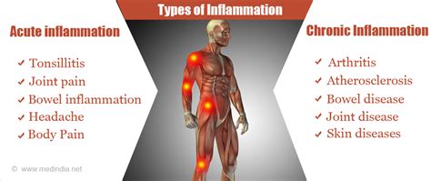 Inflammation Causes Symptoms Diagnosis Treatment Prevention