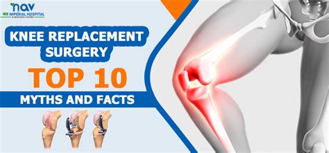 Top 10 Myths Facts About Knee Replacement Surgery