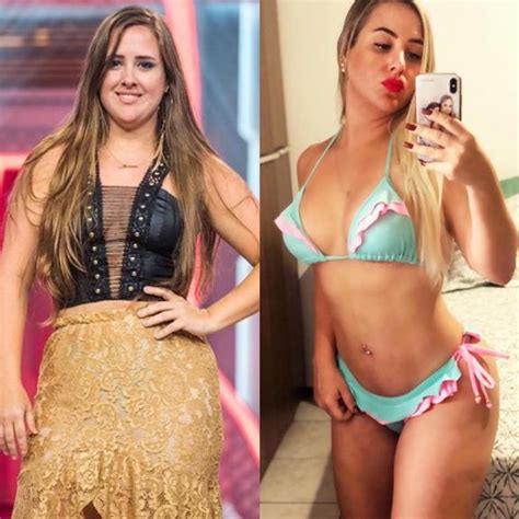 Patr Cia Leitte Surpreende Seguidores Ao Postar Antes E Depois