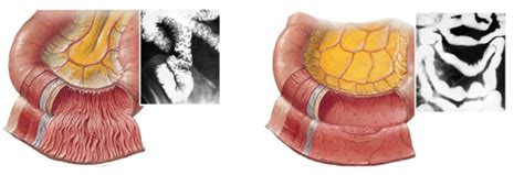 Jejunum And Ileum Diagram Quizlet