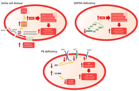 Oxidative Stress In Red Blood Cell Diseases Encyclopedia MDPI