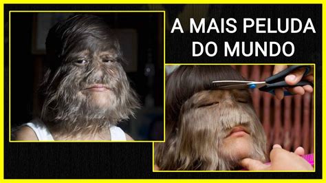 A GAROTA MAIS PELUDA DO MUNDO SUPATRA NAT SASUPHAN NOTÍCIAS
