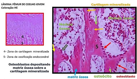 Tecendo Histologia Tecido Ósseo verloop io