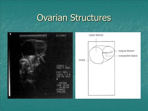 PPT Ultrasound Of The Reproductive System Stacy Fielding PowerPoint