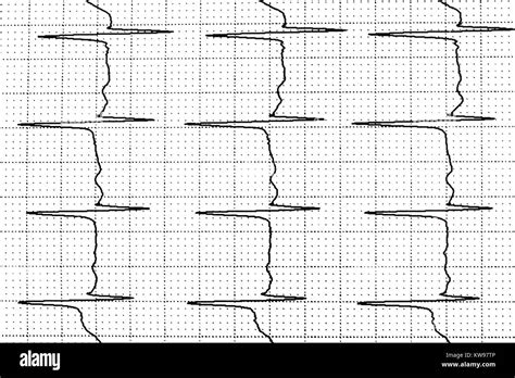 Electrocardiograma prueba que muestra la actividad eléctrica del