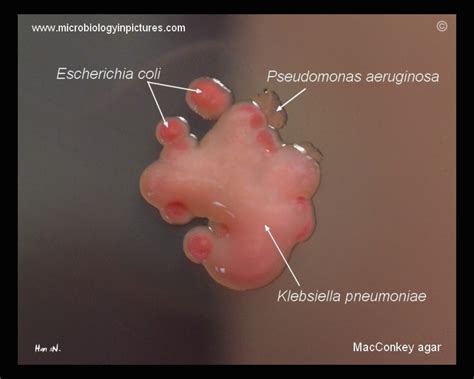E Coli And Pseudomonas Aeruginosa Colony Appearance On MacConkey Agar