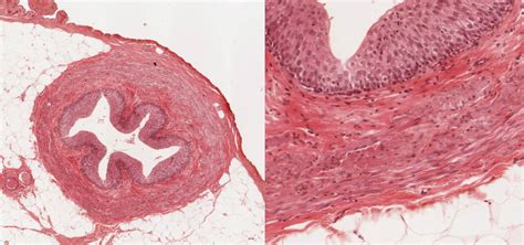 Anatomy Physiology II Lab Final Exam Ureter Histology Diagram