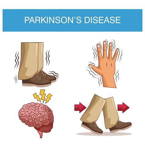 Enfermedad de parkinson infografía Vector Premium