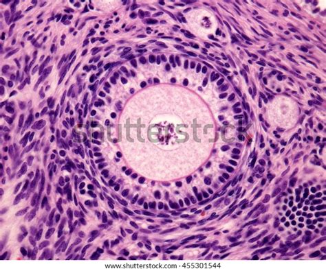 Light Microscope Micrograph Ovary Primary Follicle Stock Fotografie
