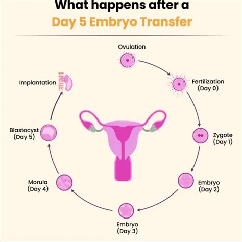 What Happens Day By Day After An Embryo Transfer Nua Fertility
