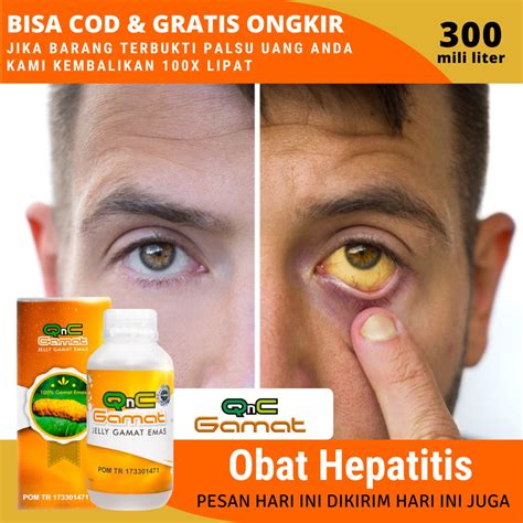 Jual Obat Hepatitis A B C Hepatitis Kronis Obat Sakit Kuning Obat