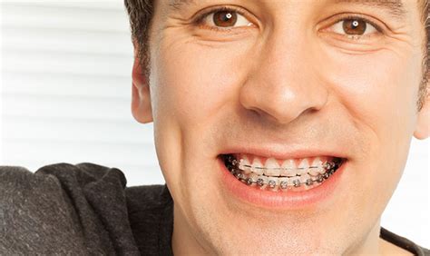 Orthodontic GuideDr Jacquie Monroe Ortho