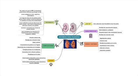 Enfermedad Renal Mind Map EdrawMax EdrawMax Templates