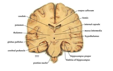 Neuro EXAM 2 Basal Ganglia And Cerebellum In Motor Control Flashcards