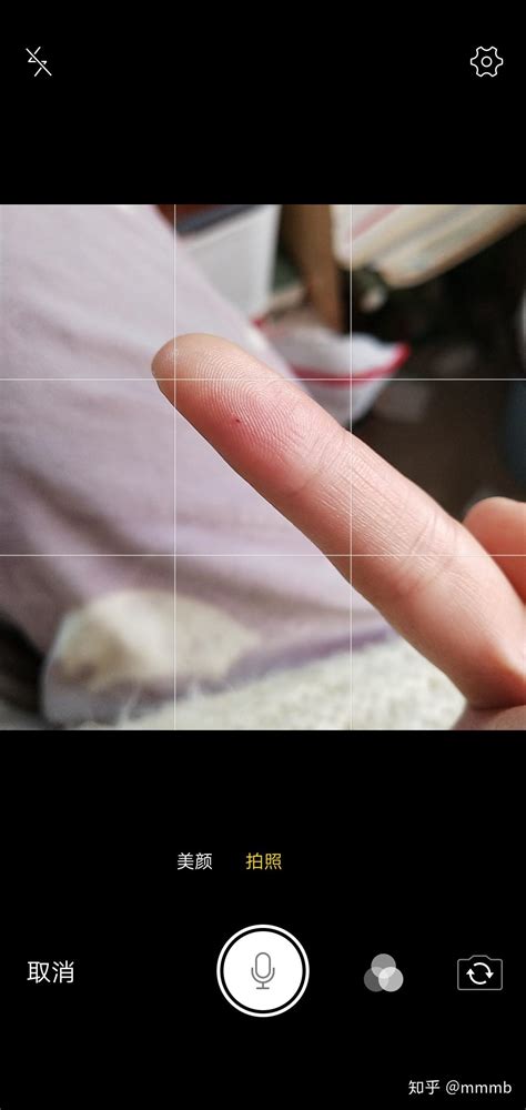 手指上莫名其妙出现一个皮下血点 知乎