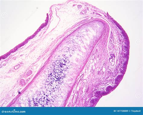 Histolog A Del Tejido Humano De La Epiglotis Imagen De Archivo Imagen