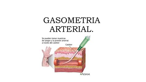 Gasometria Arterial T Cnica De Extracci N Pptx
