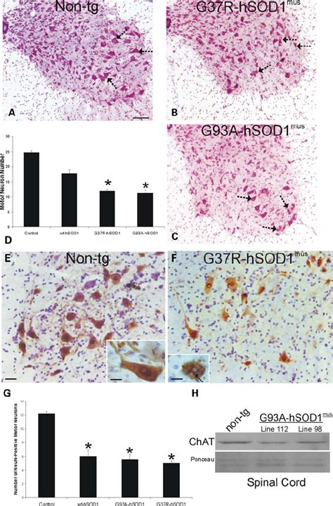 HSOD1 Mus Tg Mice Expressing Mutant Variants Have Loss Of Spinal MNs At