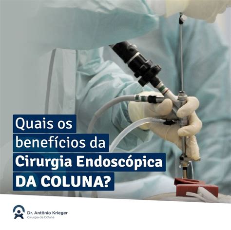 Quais Os Benef Cios Da Cirurgia Endosc Pica Da Coluna Dr Ant Nio