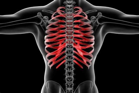 Costocondrite Sintomas E Tratamento