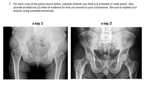 Male Vs Female Pelvis Diagram Quizlet