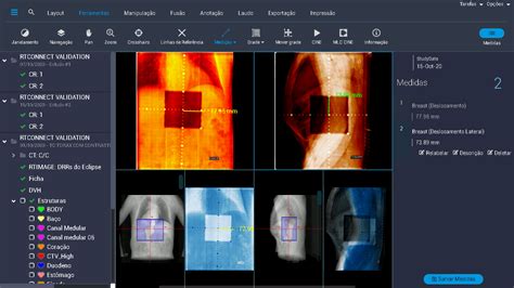 What Are The Differences Between PACS RIS CIS LIS And HIS