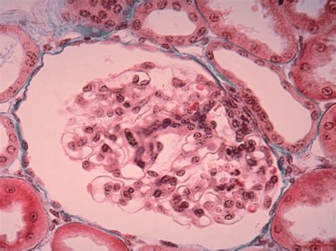 Exam Urinary System Histology Flashcards Quizlet