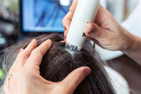 Transplante Capilar Feminino Mais Cabello