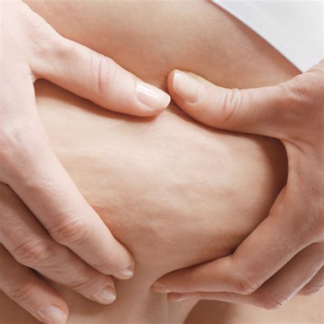 Sagen Sie Ihren Dellen den Kampf an Alexia Höfinger Beauty Lounge Spa