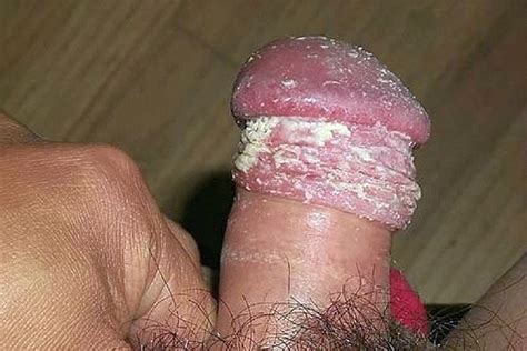 Dick Cheese Porn Telegraph