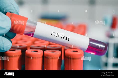 Parathyroid Glands Parathyroid Hormone PTH Test Most Important