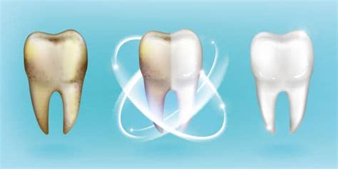 Hipoplasia dental qué es causas y tratamiento Face Clinic