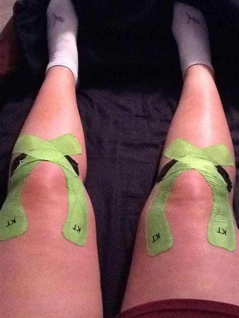 Ex Kinesiology Tape Patella Knee Pain Artofit