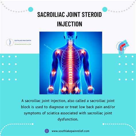 Sacroiliac Joint Steroid Injection Procedure South Lake Pain Center