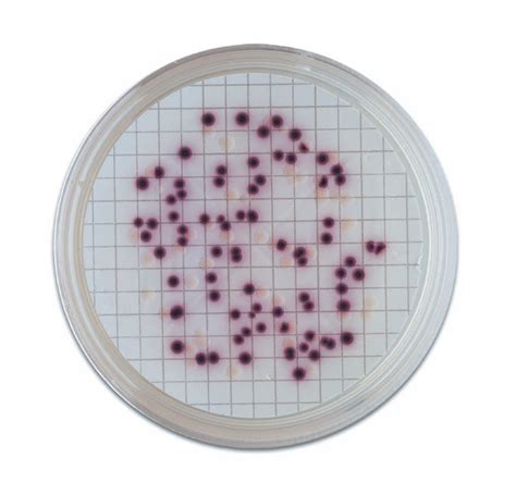 BD BBL Prepared Plated Chromogenic Media MI Agar Fisher Scientific