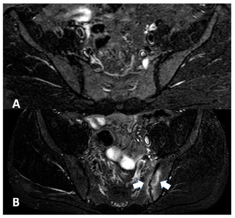 Gastroenterology Insights Free Full Text Imaging In The Assessment