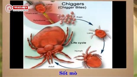Bệnh sốt mò là gì Có nguy hiểm như thế nào đến sức khỏe của bạn Cẩm