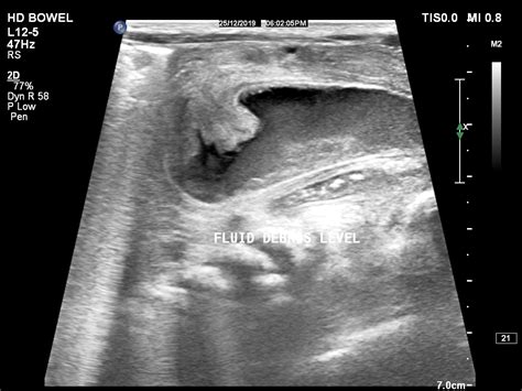 Image Radiopaedia Org