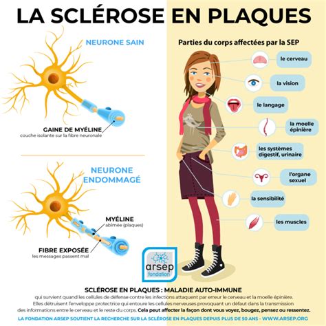 La SEP En Quelques Mots Sep UP