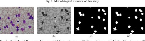 figure 1 from efficient segmentation techniques for the automated detection of acute