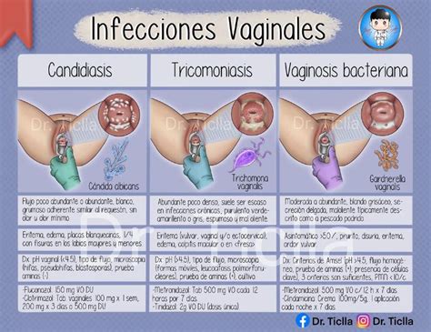 Infecciones Vulvovaginales Jhan Carlos Ticlla Mori UDocz