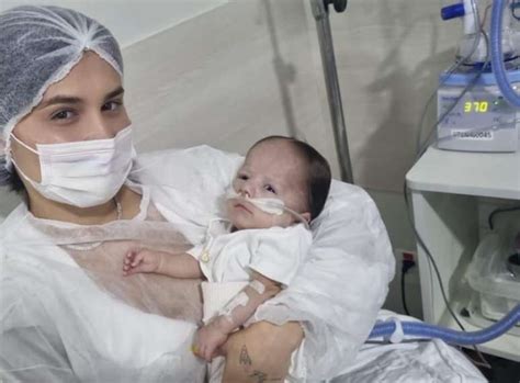 Síndrome de Patau entenda a condição rara que acomete o filho Sinta a