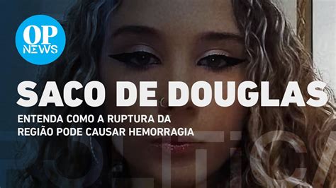 Saiba o que é saco de Douglas e como sua ruptura pode causar hemorragia